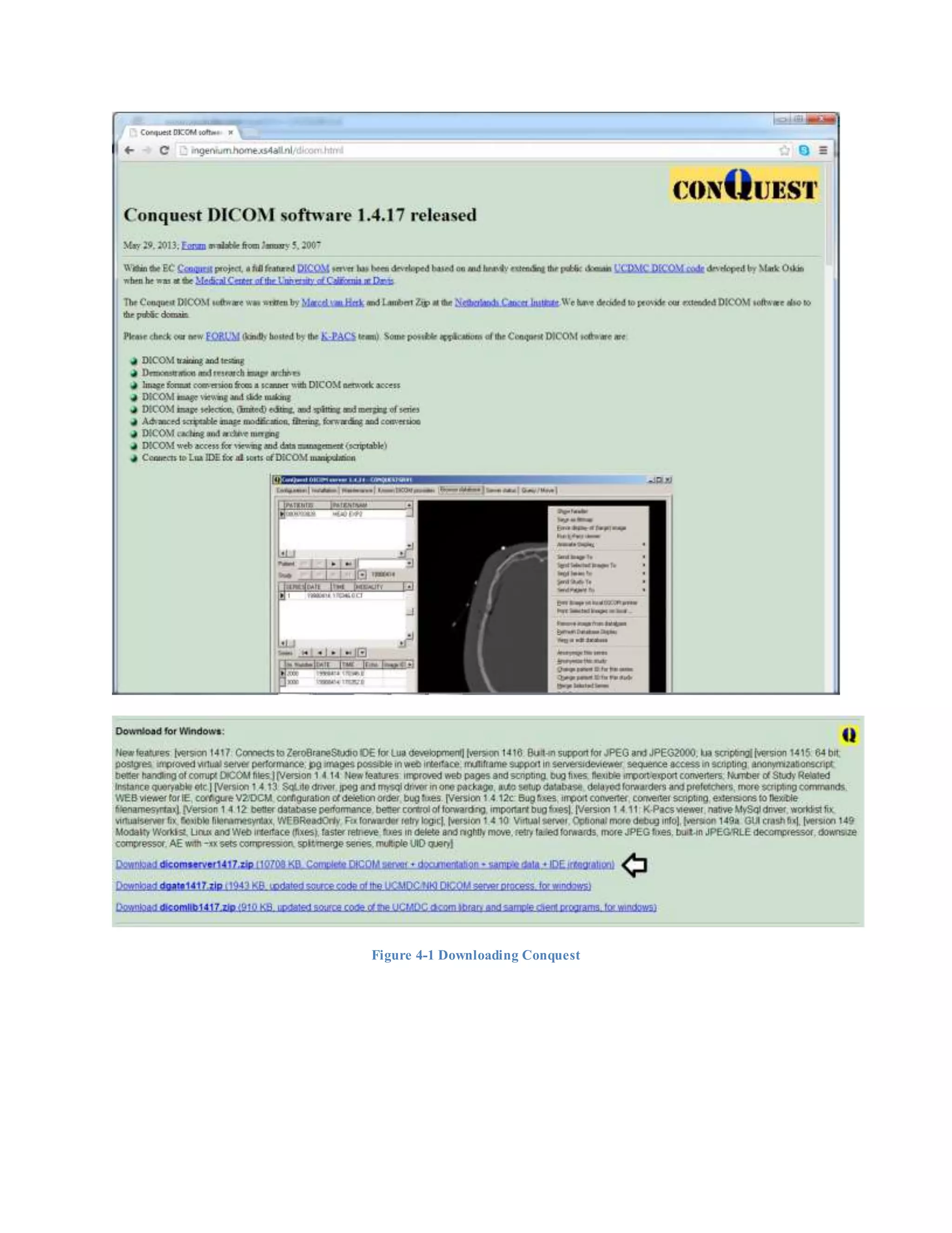 Conquest for dummies: how to setup a pacs server | DOCX