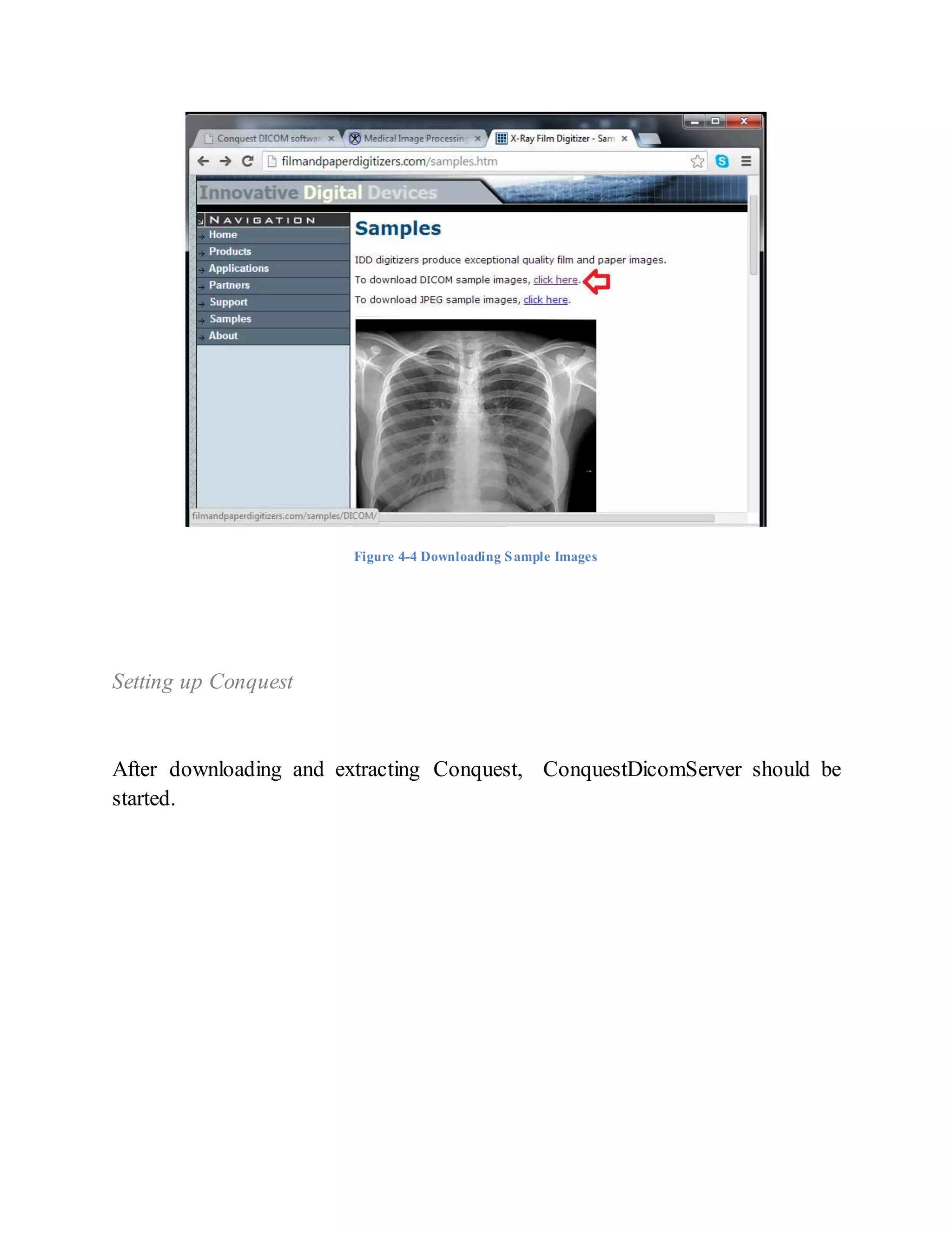 Conquest for dummies: how to setup a pacs server | DOCX