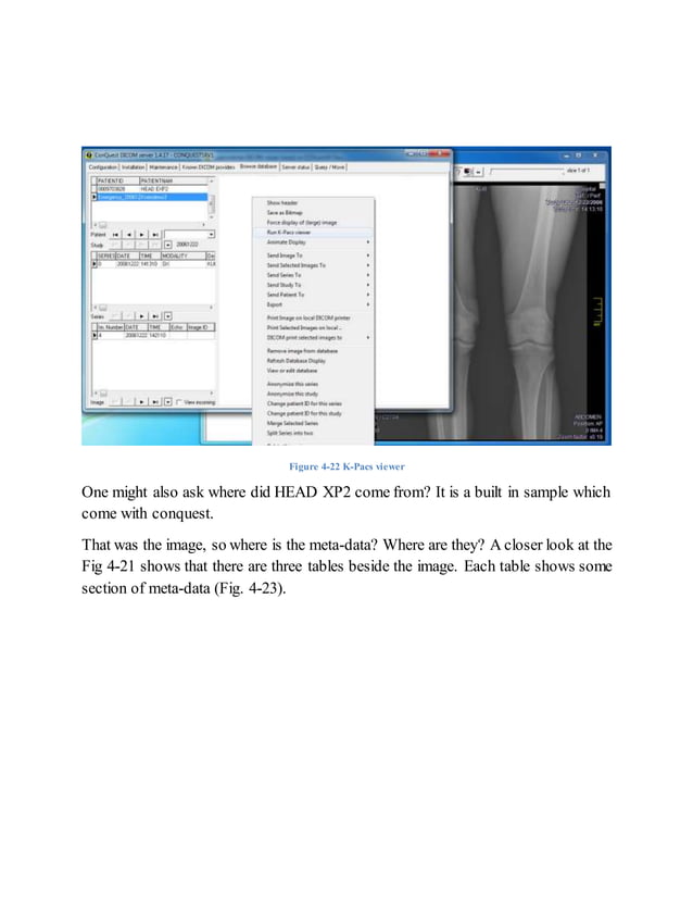 Conquest for dummies: how to setup a pacs server | DOCX