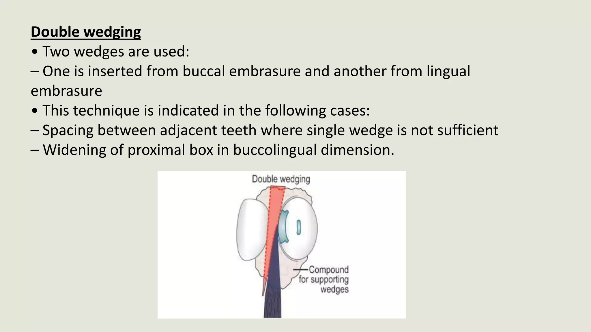Wedging technique | PPTX