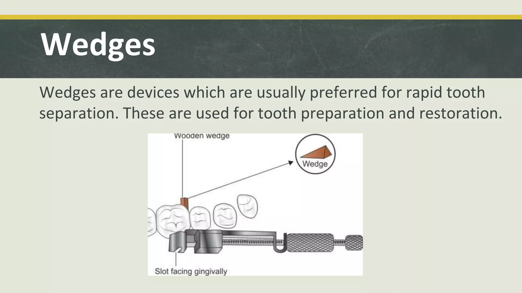 Wedging technique | PPTX