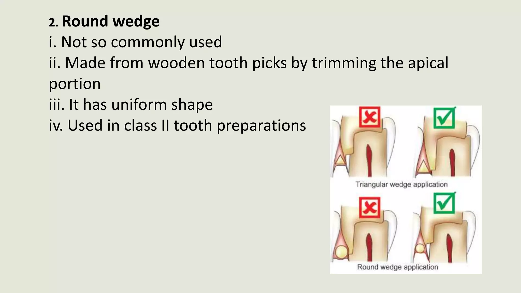 Wedging technique | PPTX