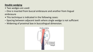 Wedging technique | PPTX