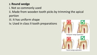 Wedging technique | PPT