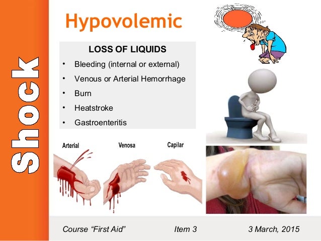 Loss Of Consciousness loss-of-consciousness