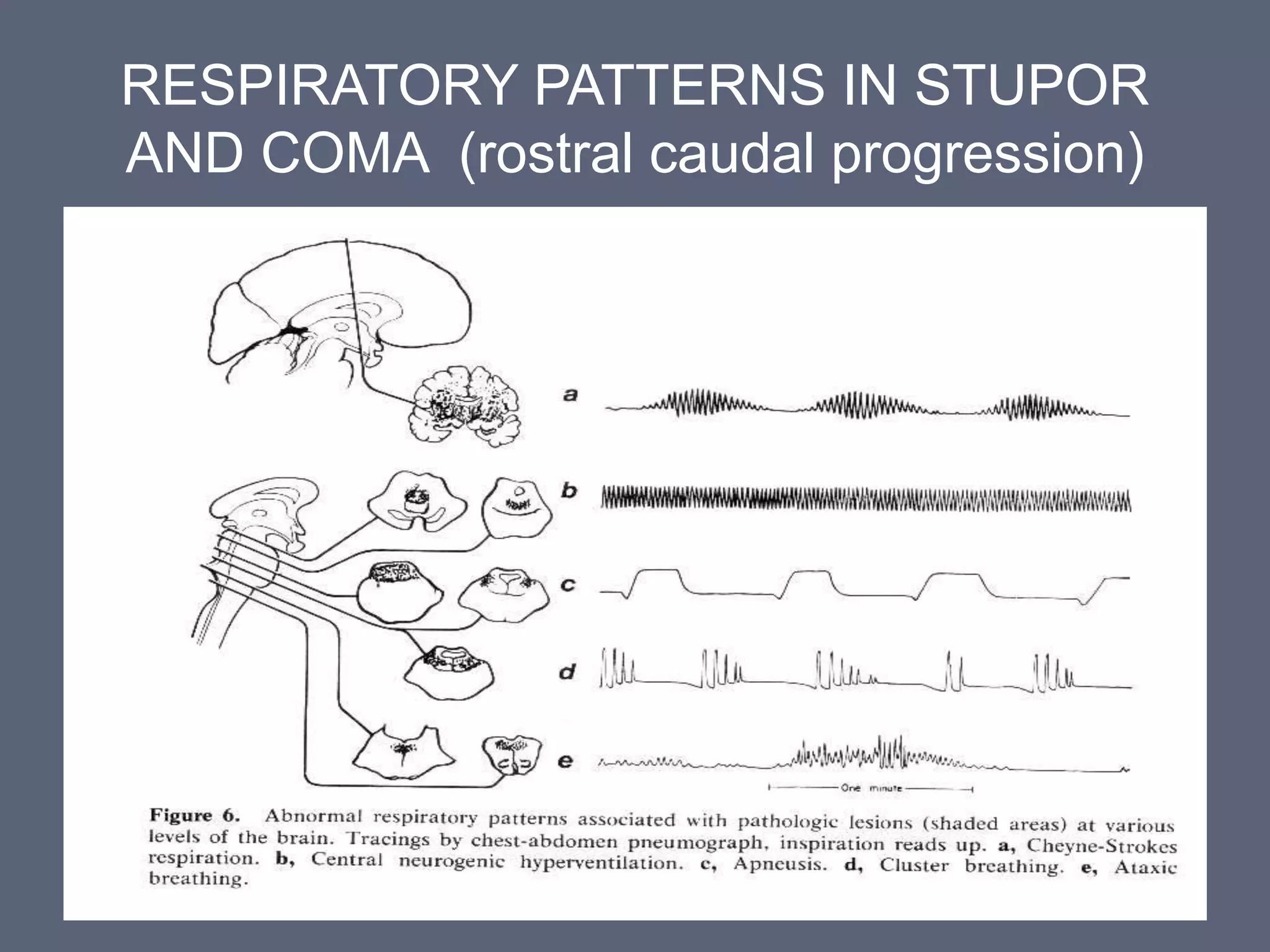 CONSCIOUSNESS-SYSTEM.ppt