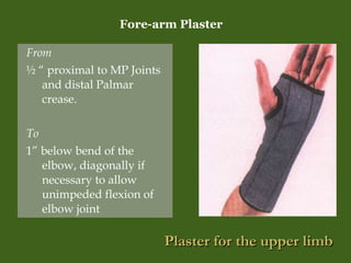 conservative management of simple fractures | PPT