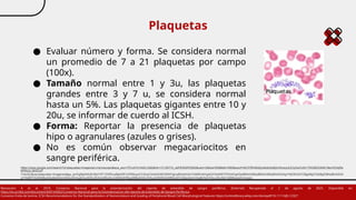 CONSENSO DE LAMINA PERIFERICA INTERNACIONAL | PPTX
