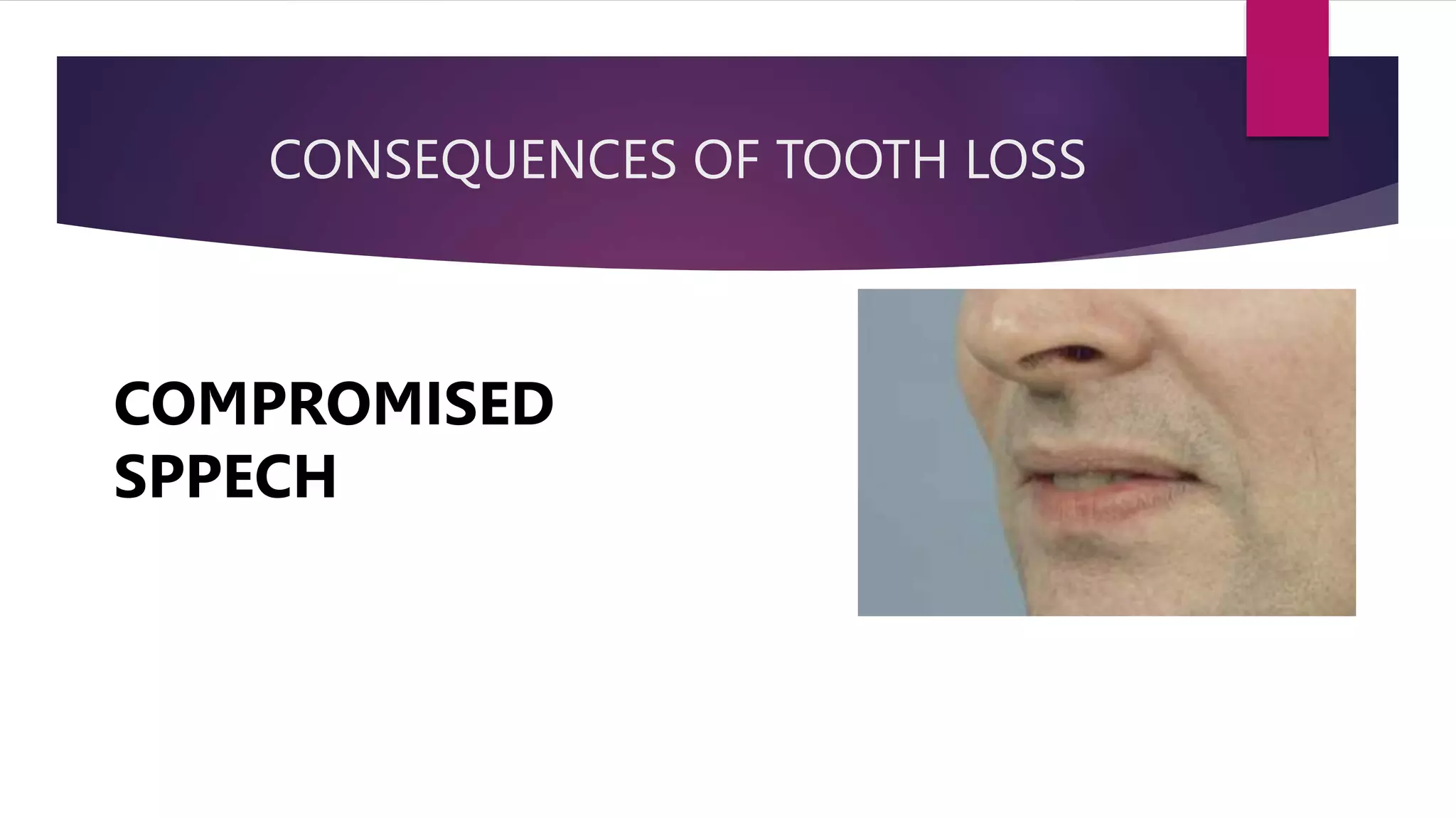 CONSEQUENCES OF TOOTH LOSS.pptx