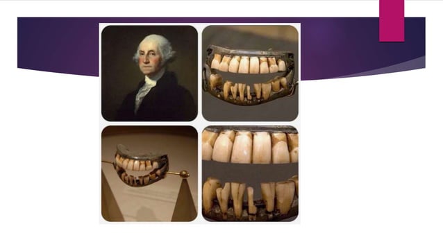 CONSEQUENCES OF TOOTH LOSS.pptx