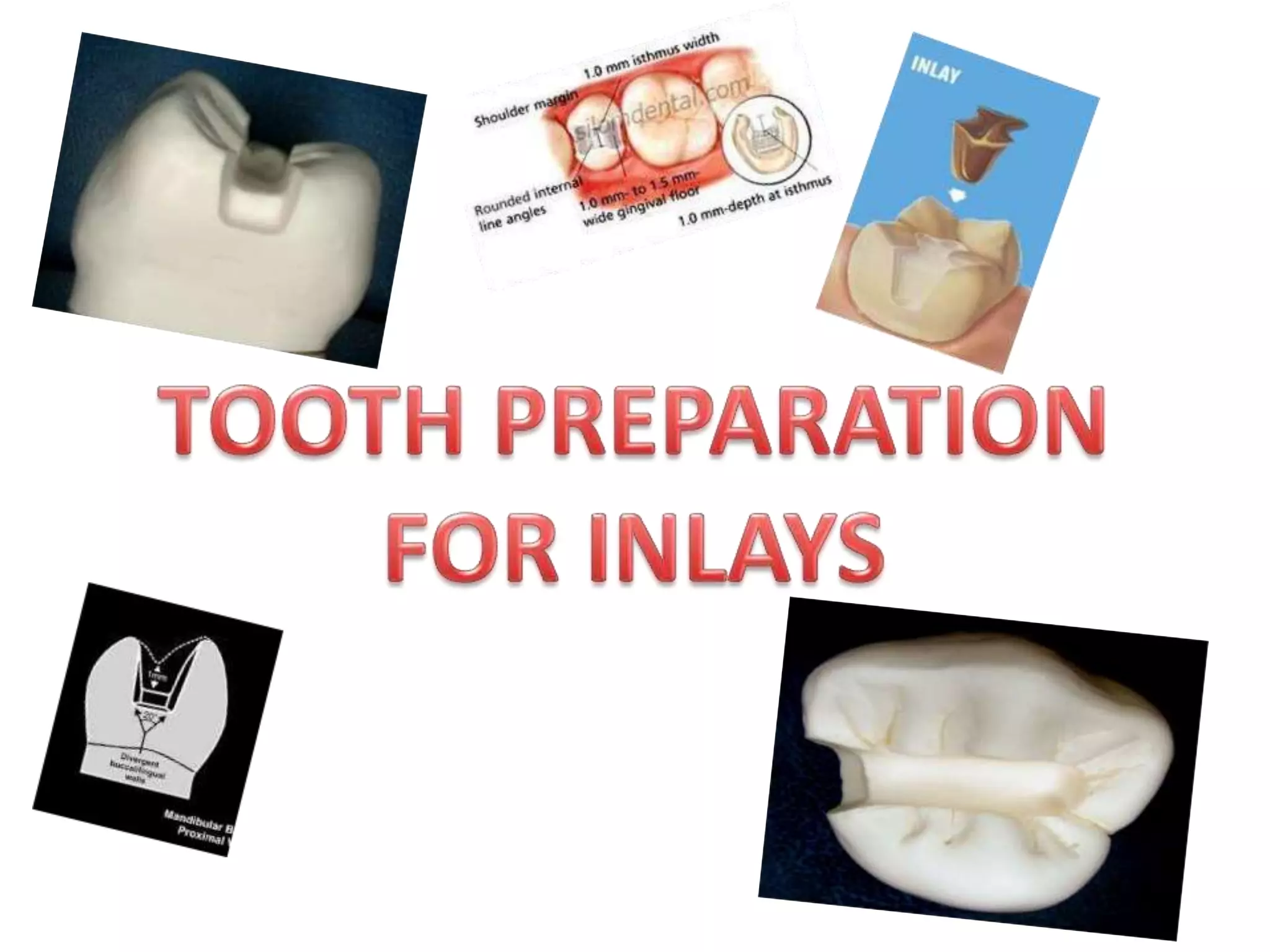 inlays&onlays | PPTX