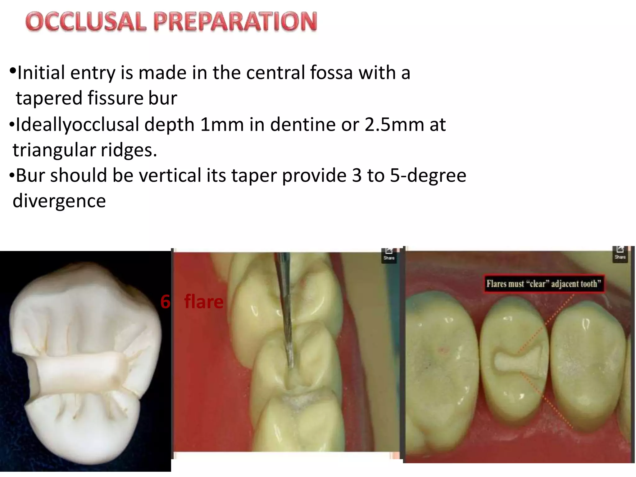 inlays&onlays | PPTX