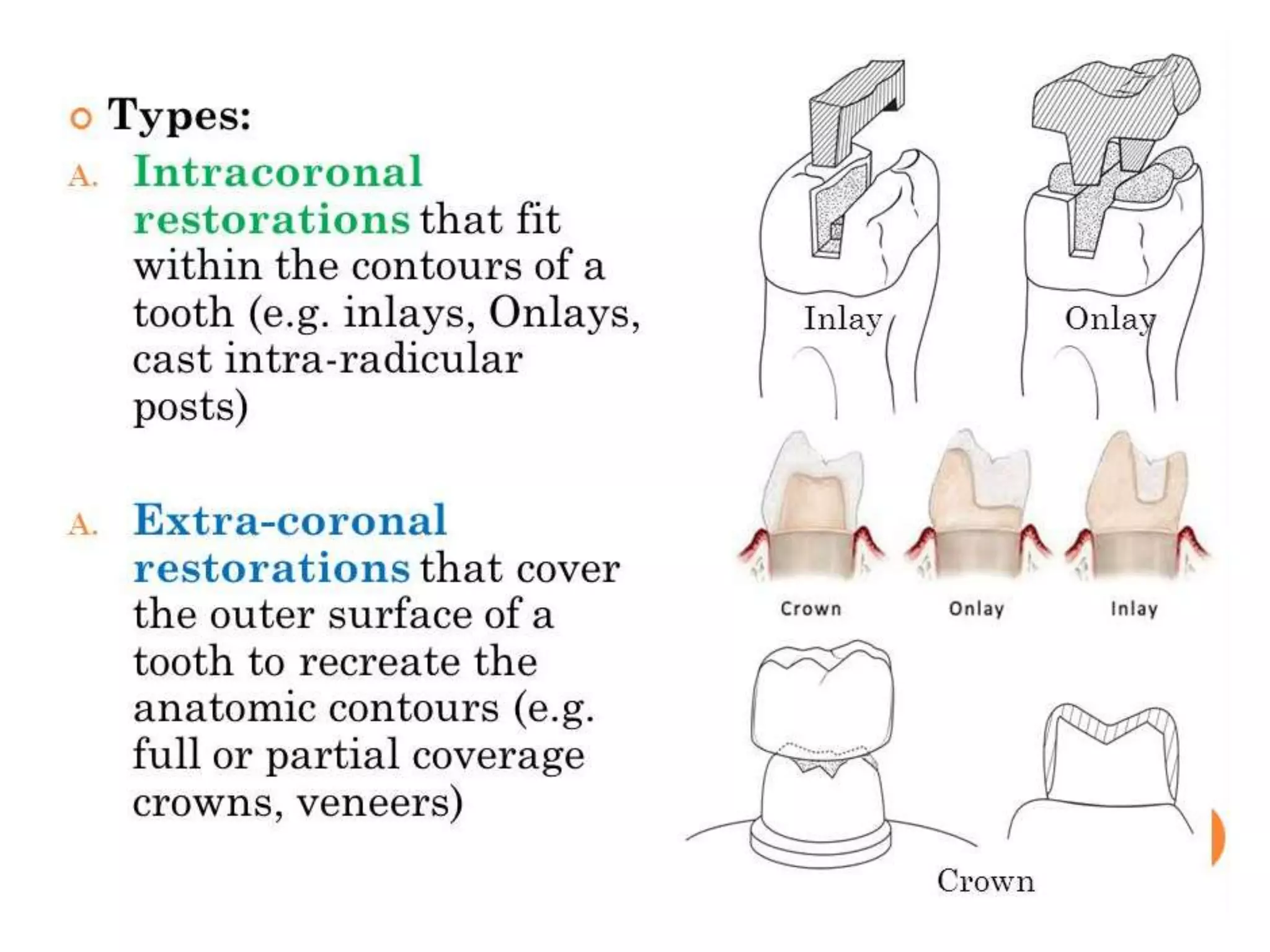 inlays&onlays | PPTX