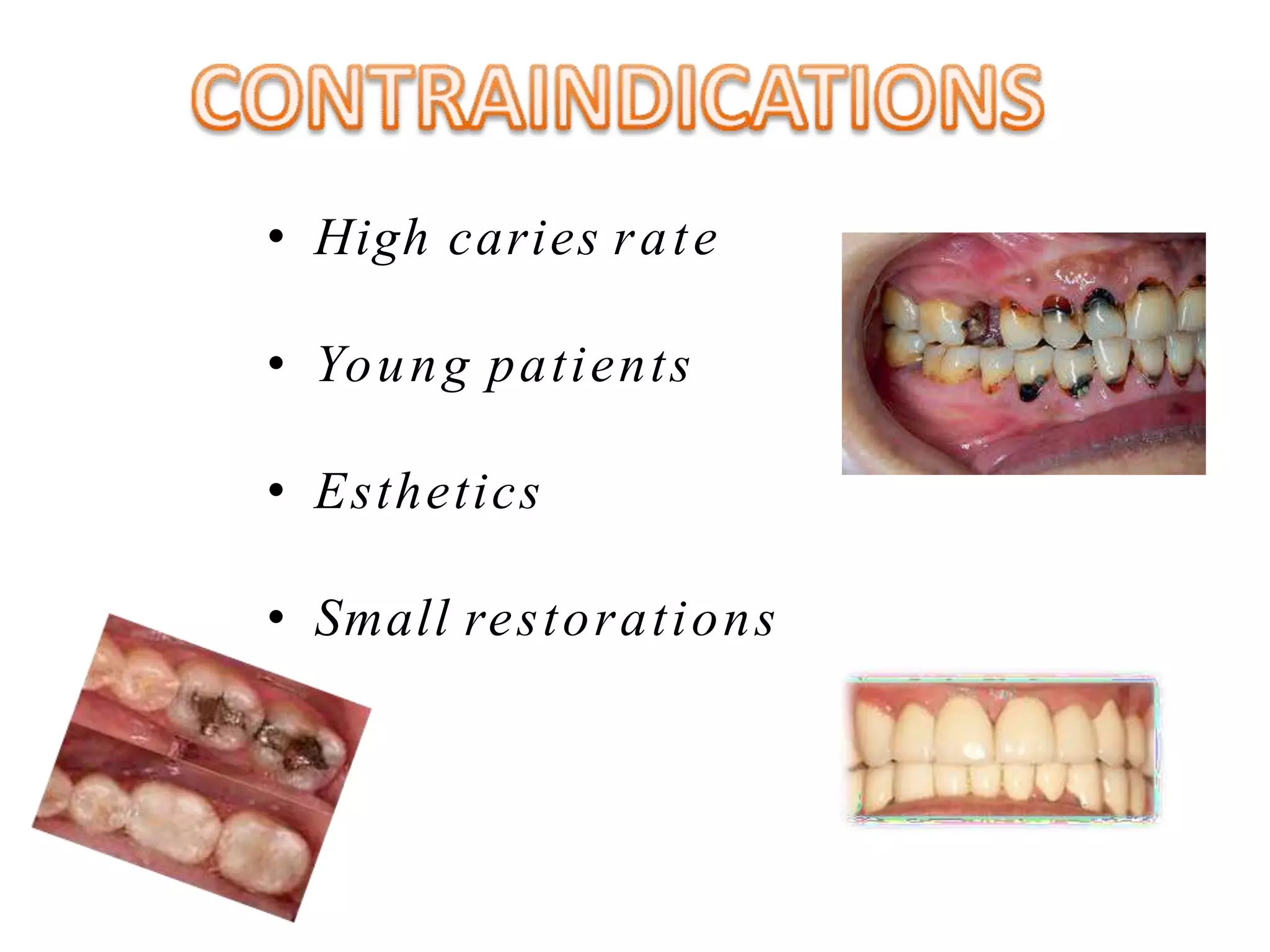inlays&onlays | PPTX