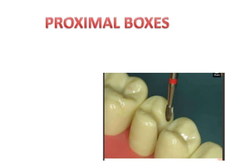 inlays&onlays | PPTX