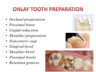 inlays&onlays | PPTX