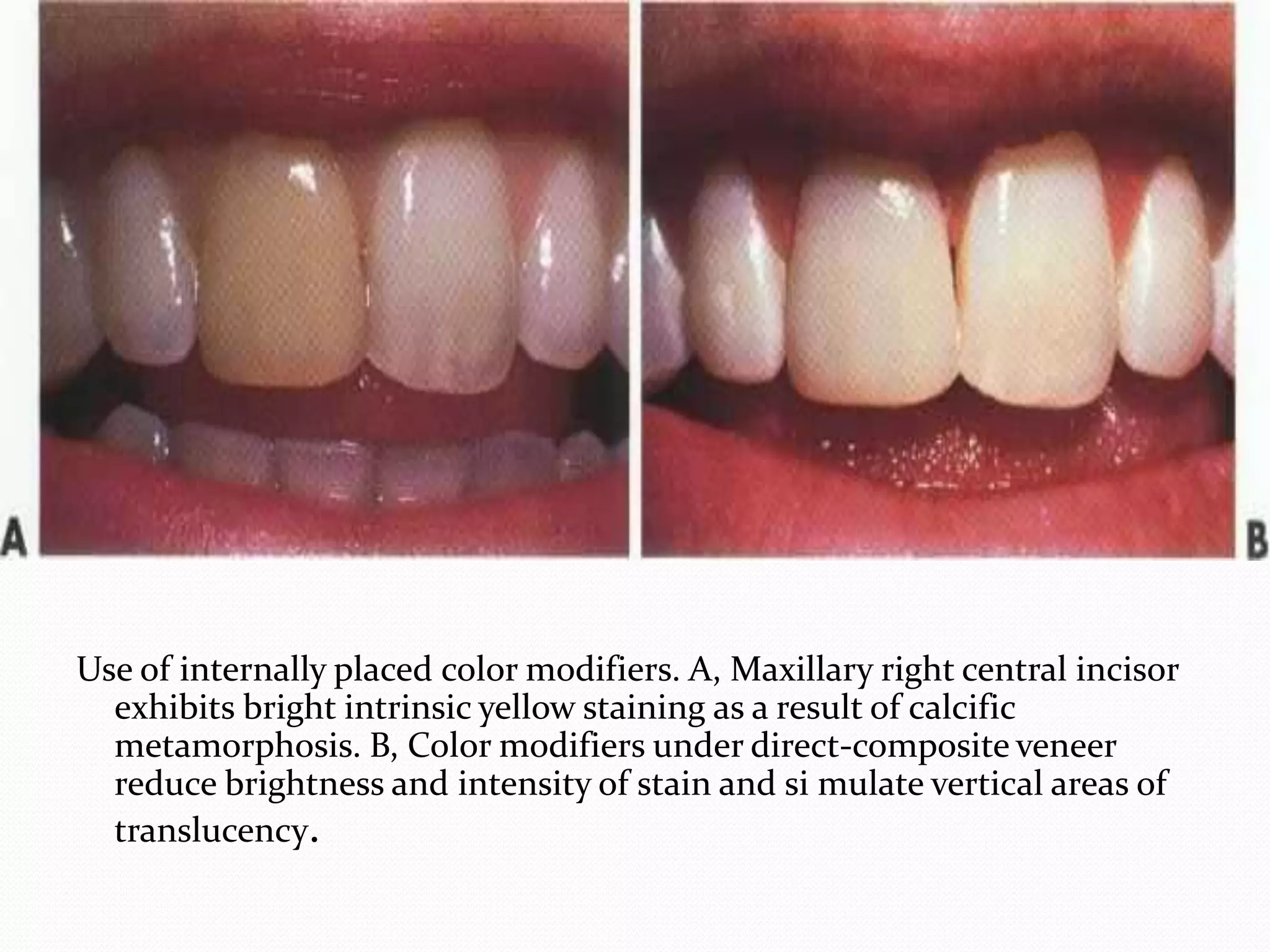 Conservative esthetic procedures | PPSX