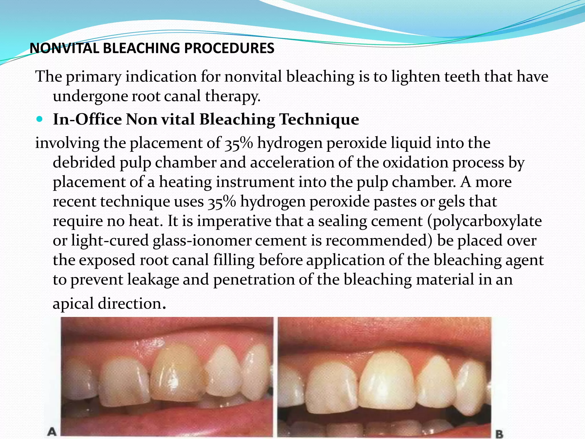 Conservative esthetic procedures | PPSX
