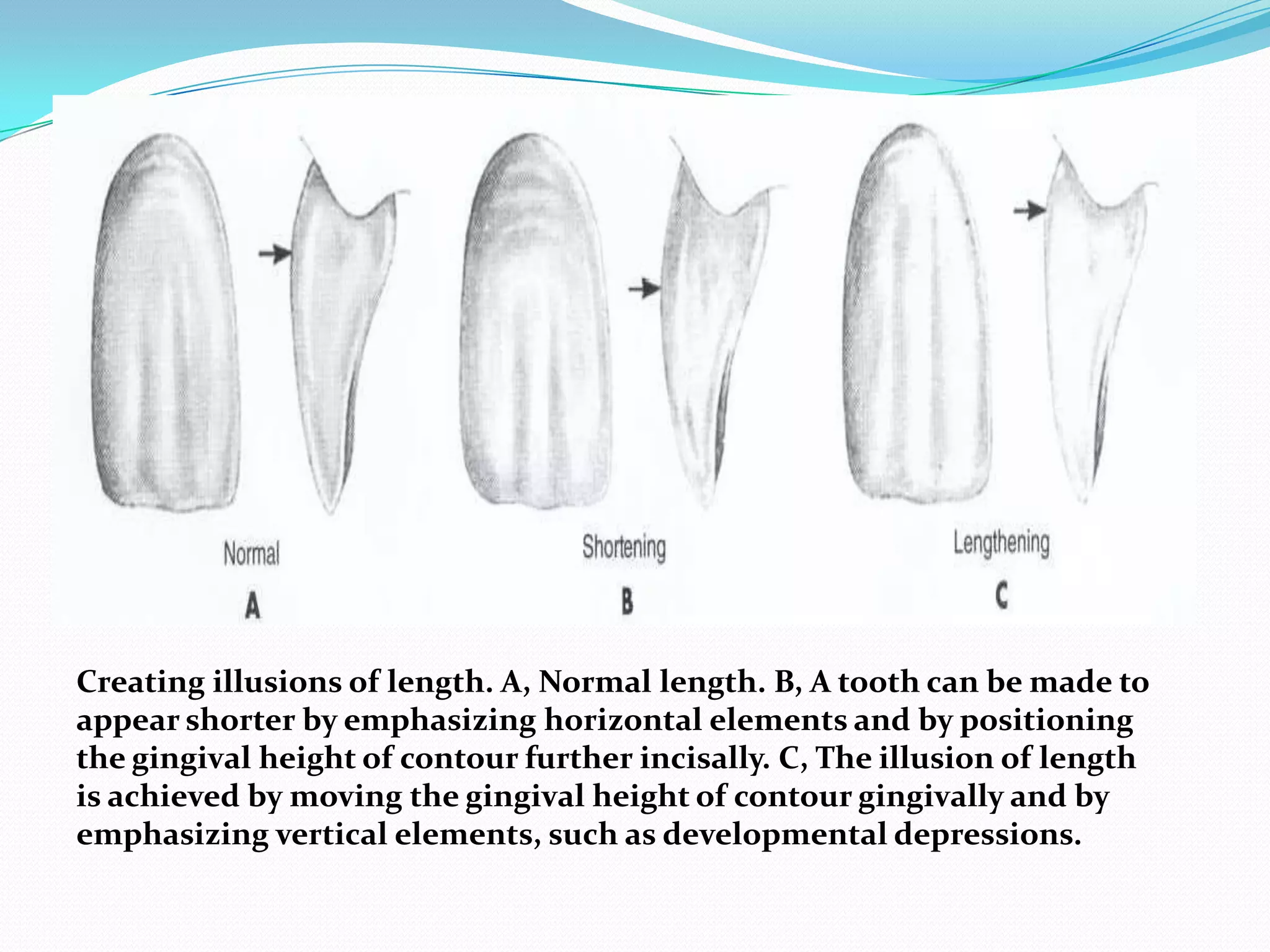 Conservative esthetic procedures | PPSX