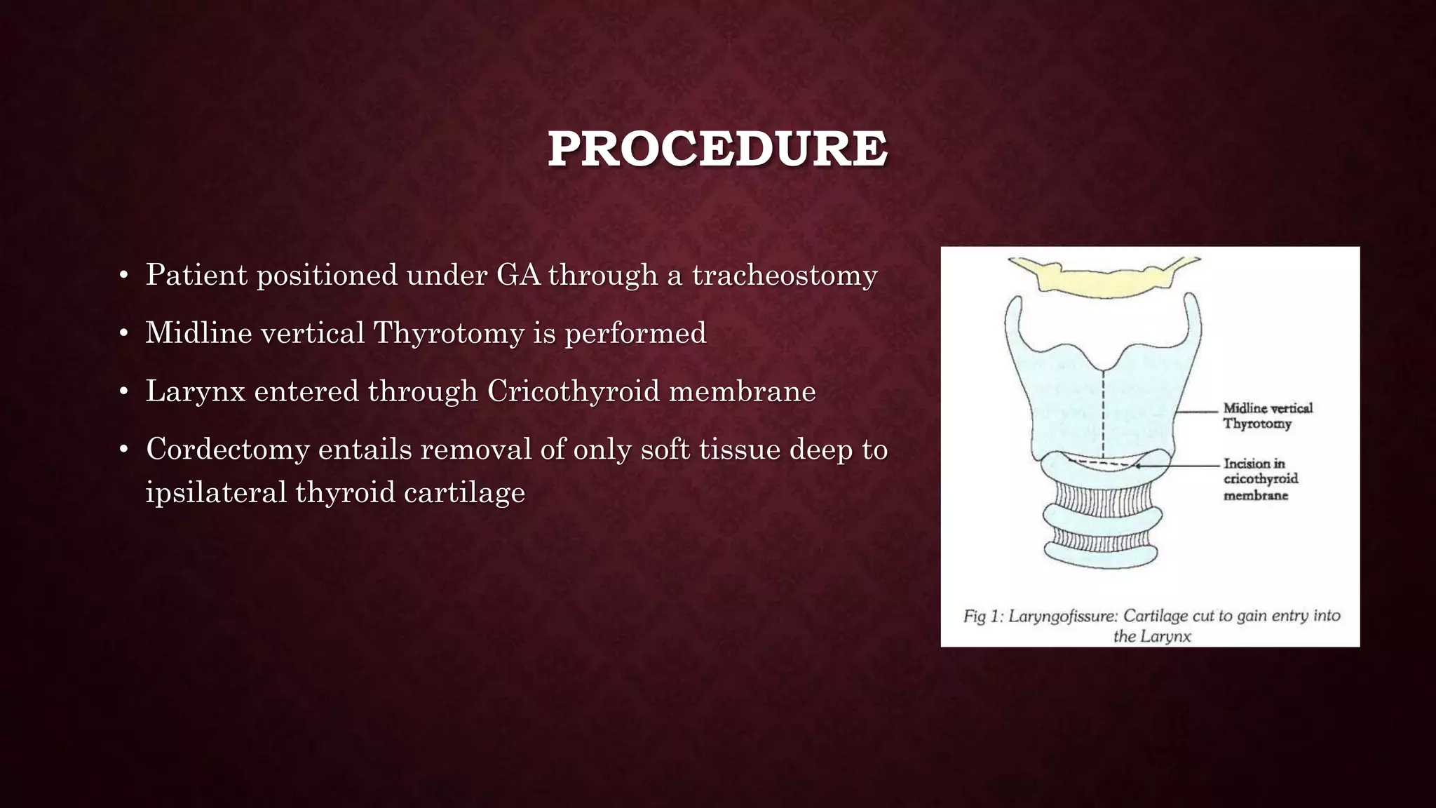 CONSERVATIVE LARYNGECTOMY.pptx