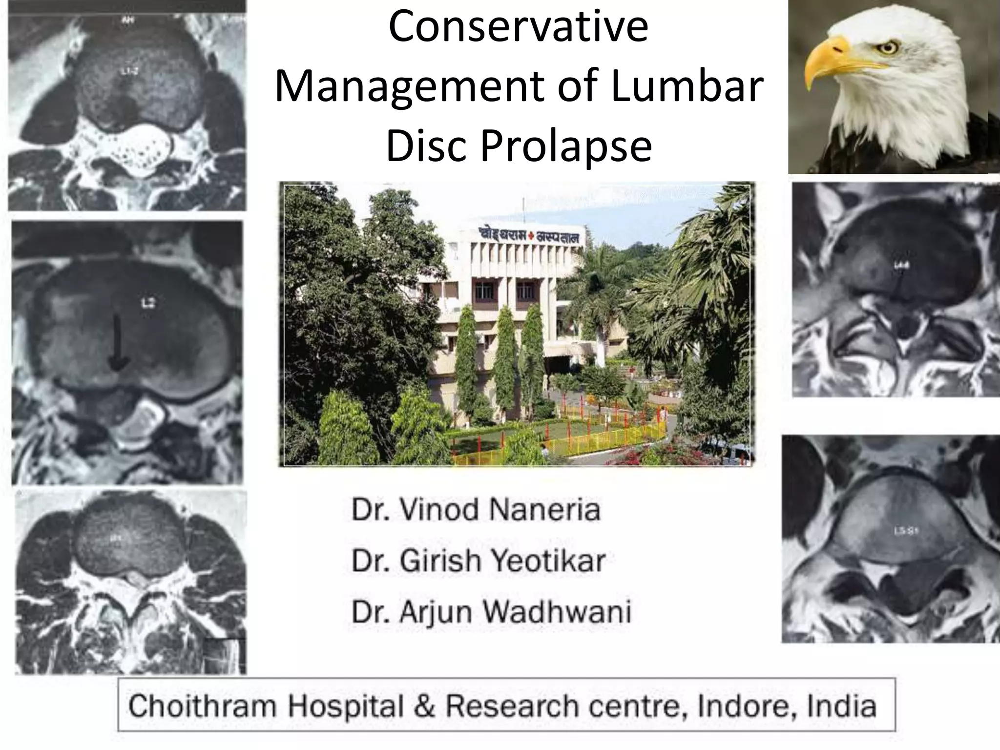 Conservative management of Lumbar disc prolapse.pptx