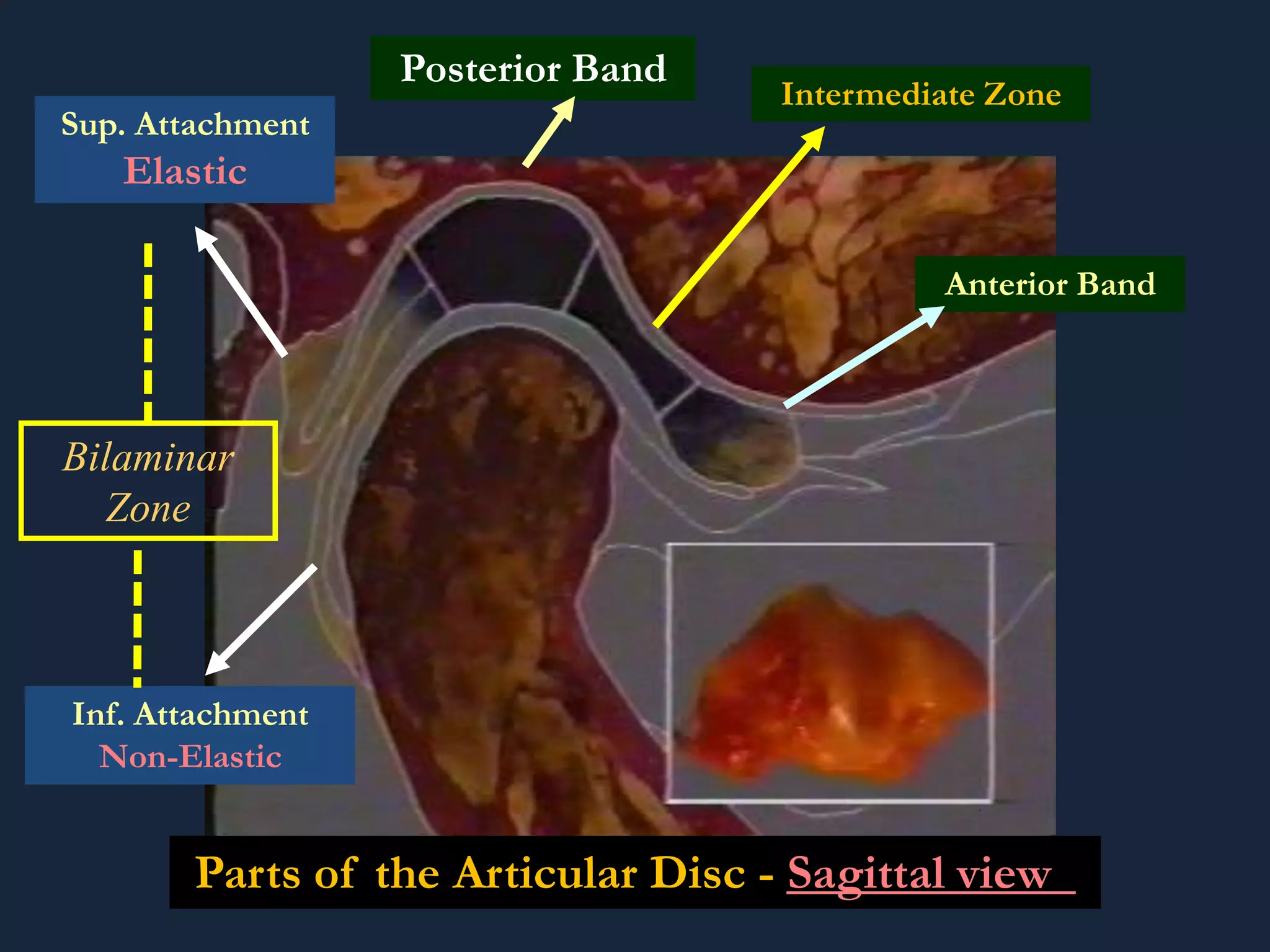 Conservative management of temporomandibular disorders | PDF