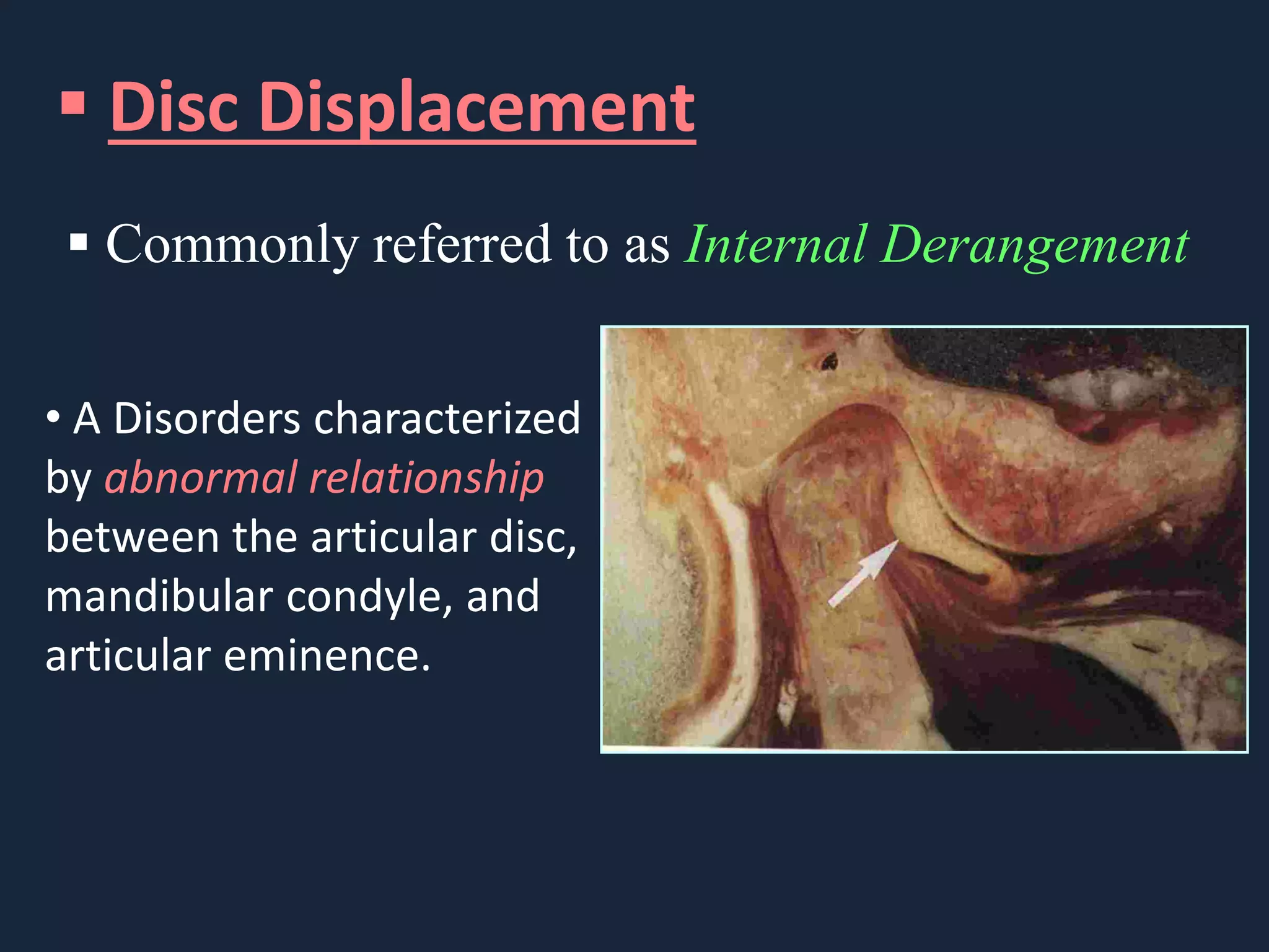 Conservative management of temporomandibular disorders | PDF