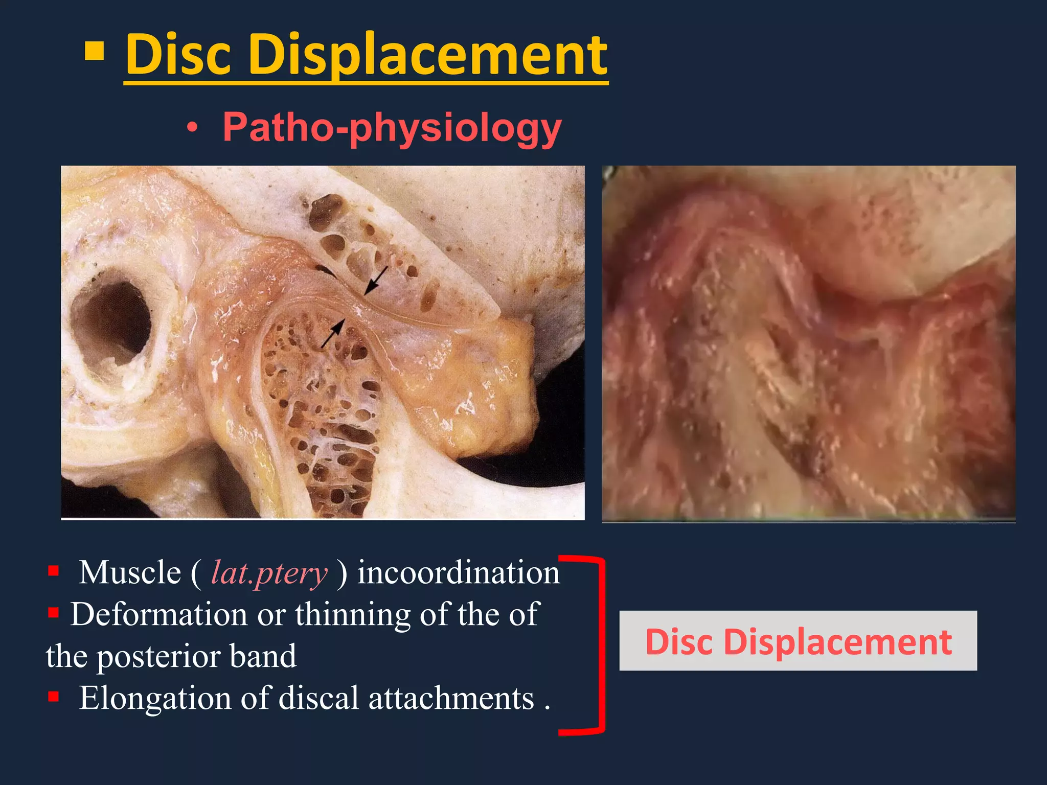 Conservative management of temporomandibular disorders | PDF