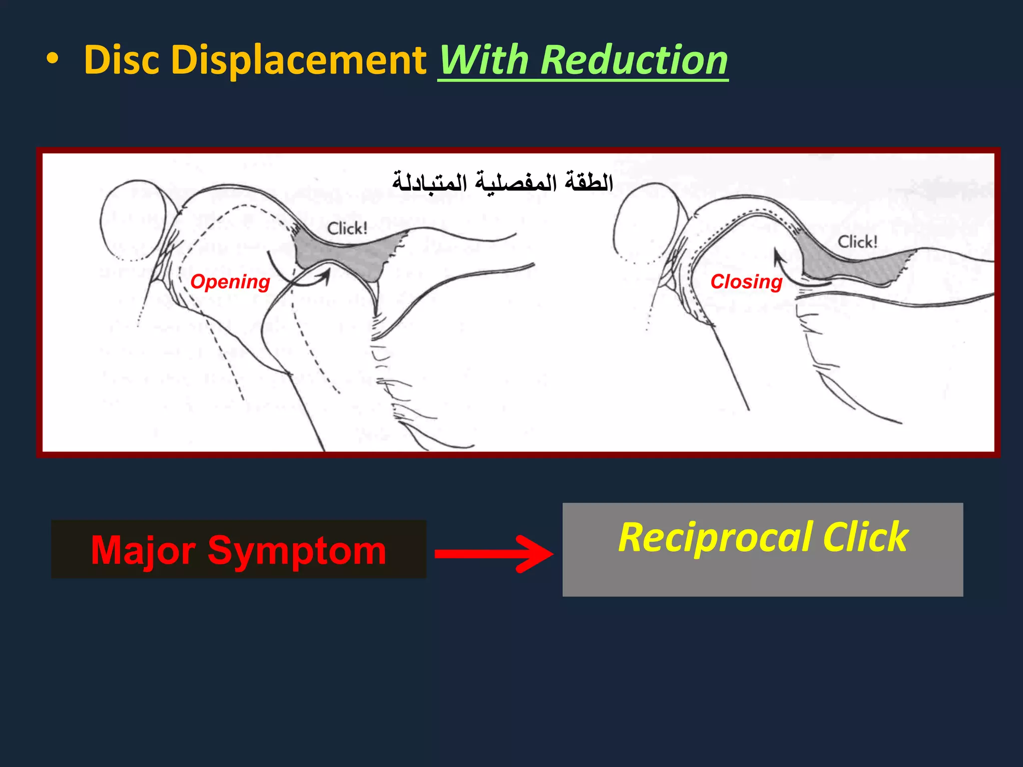 Conservative management of temporomandibular disorders | PDF