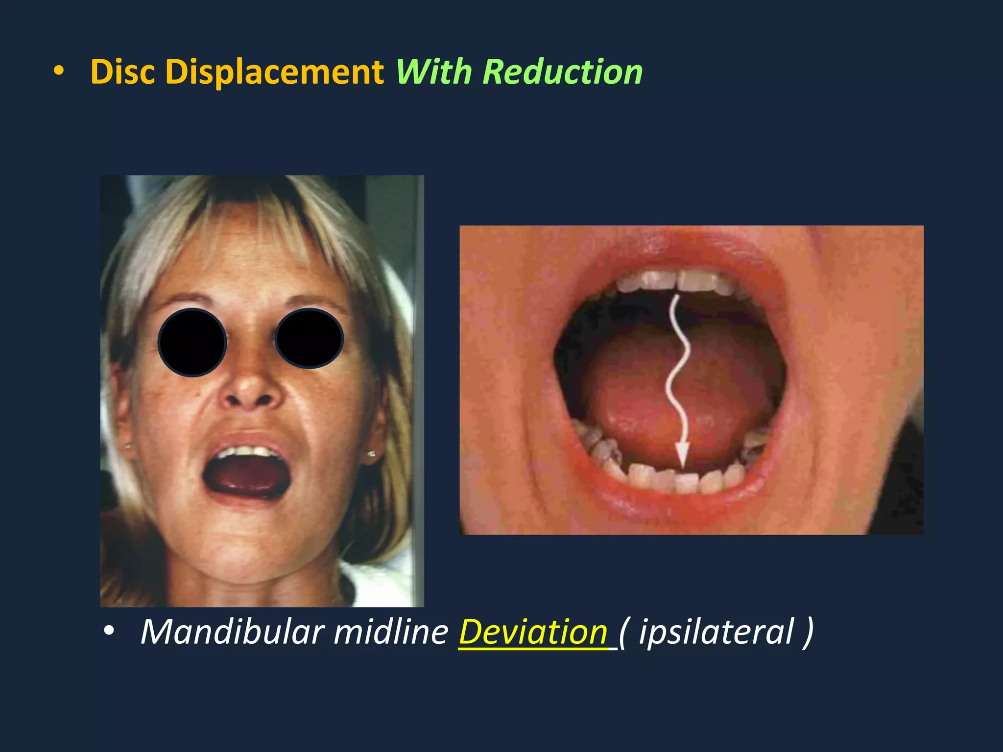 Conservative management of temporomandibular disorders | PDF