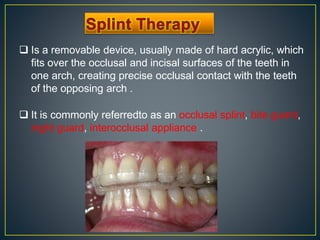 Conservative management of tmj disorder | PPTX