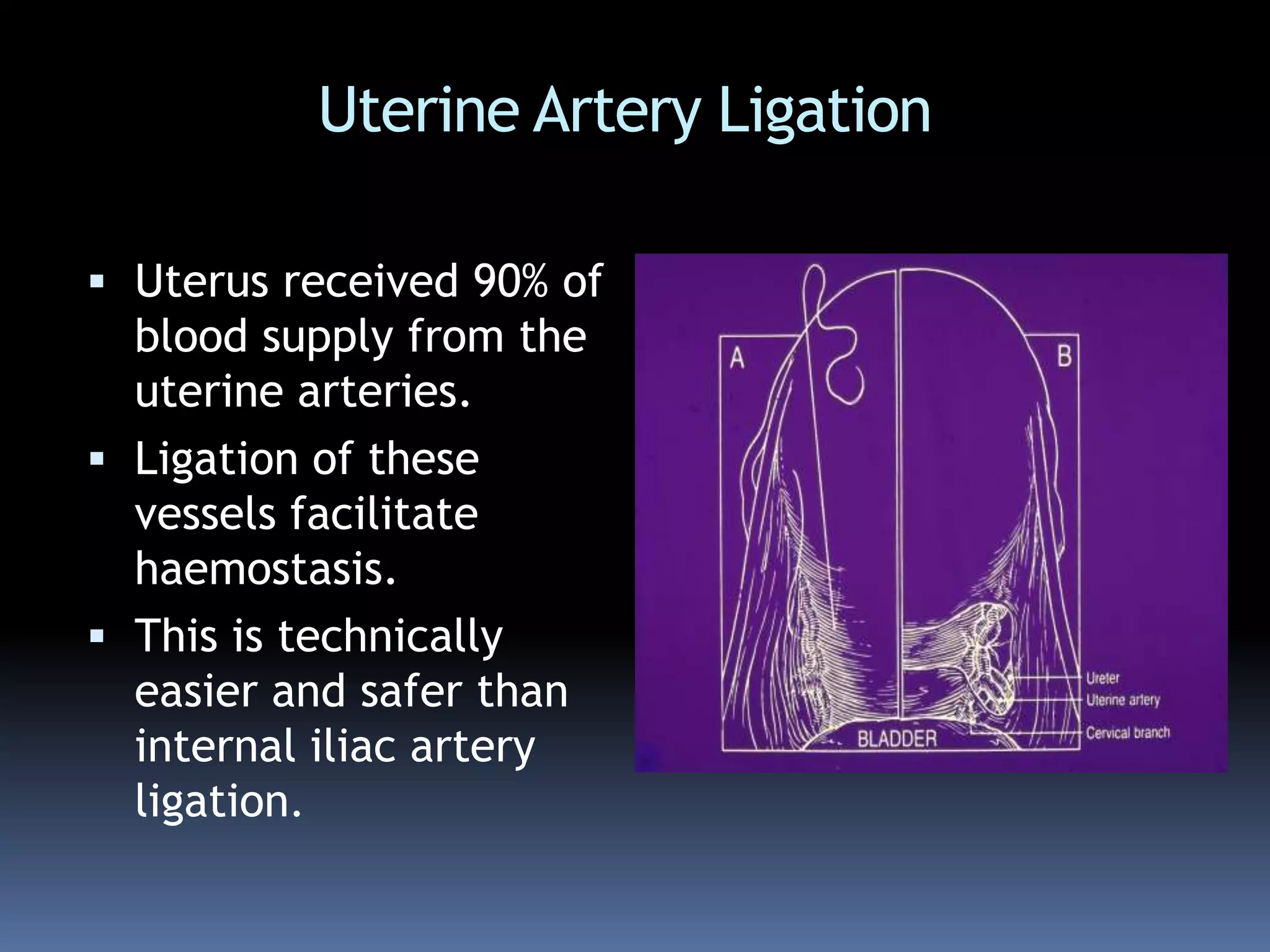 Conservative Mx of PPH | PPT