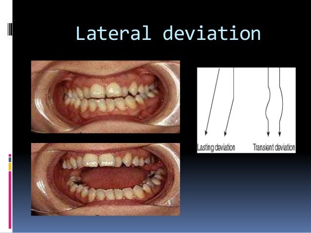 Conservative treatment of tmj disorders