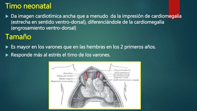 Imagenología Pediátrica Consideraciones generales sobre el timo en ...