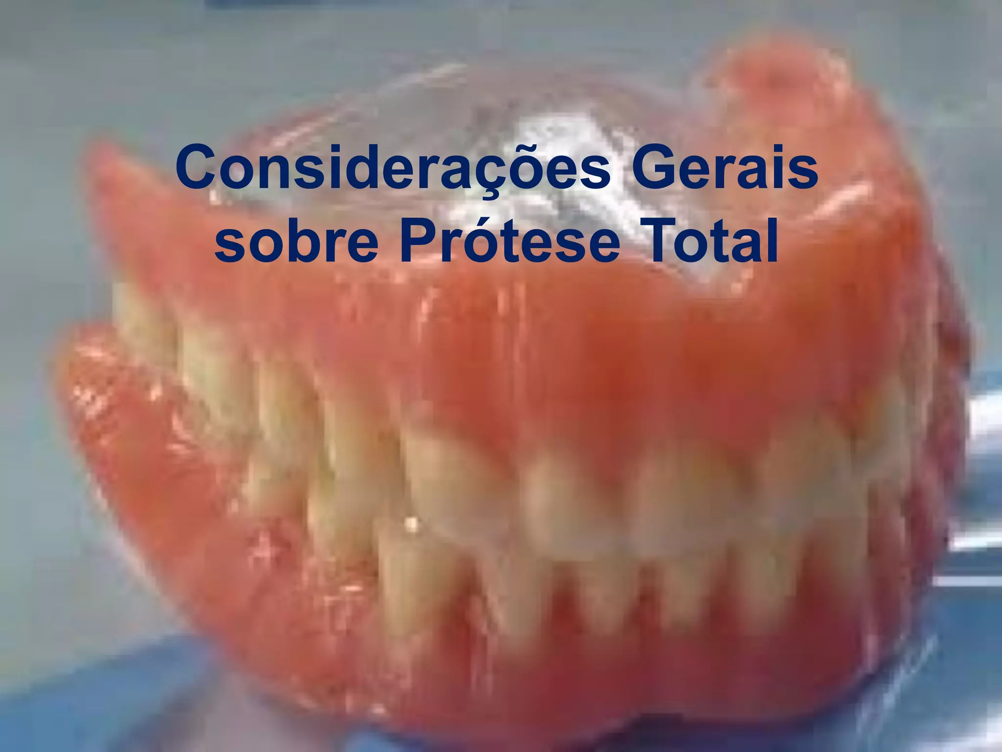 Considerações gerais sobre Prótese Total | PDF