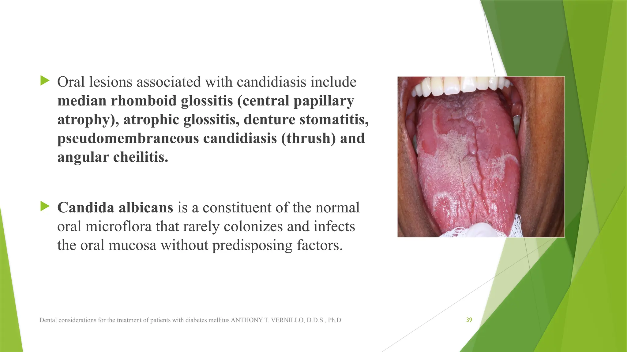 Considerations of Oral Manifestations and Prosthodontic Management of.pptx