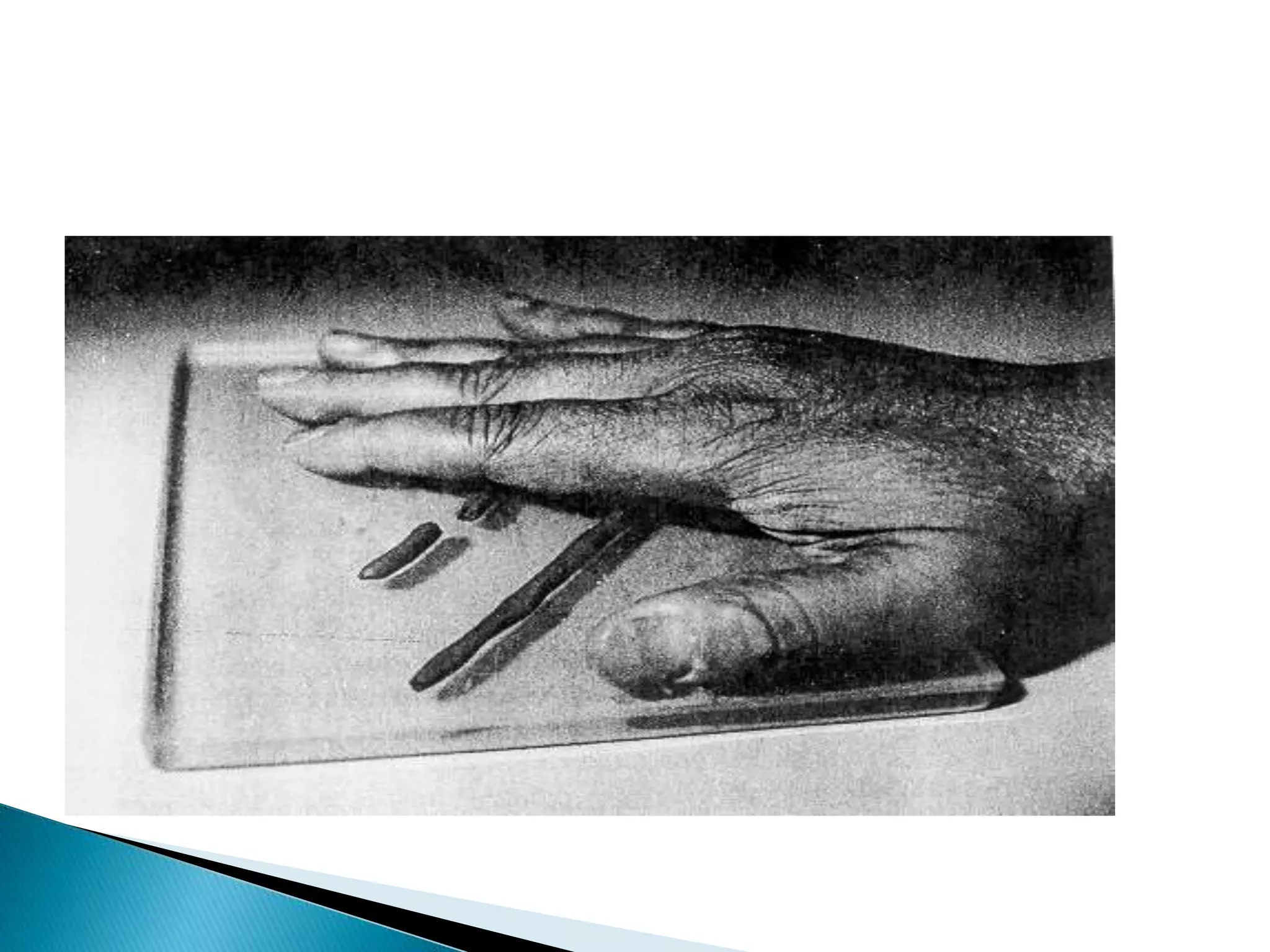 Consistency of soils | PPTX