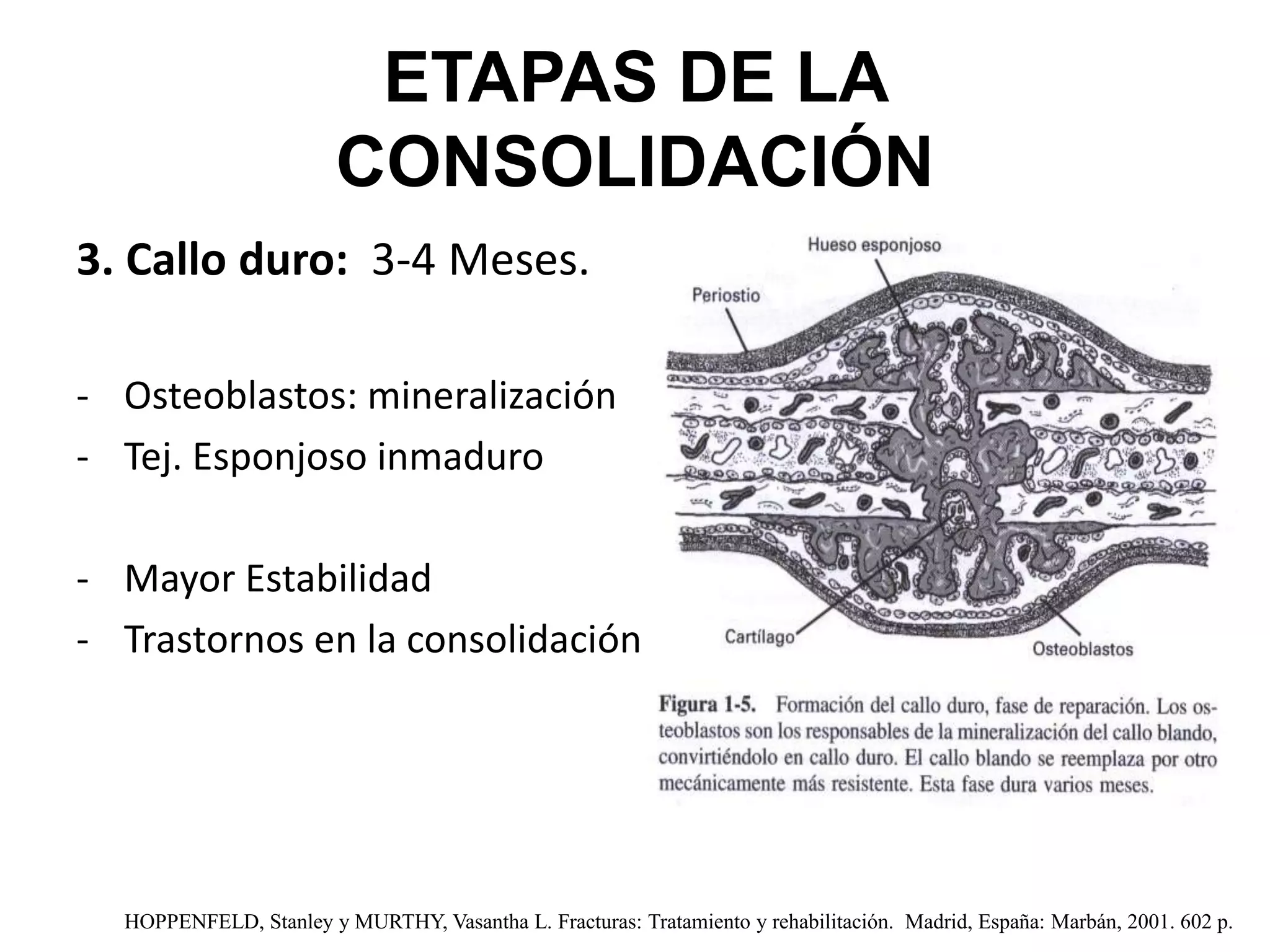 consolidacion Osea.pptx