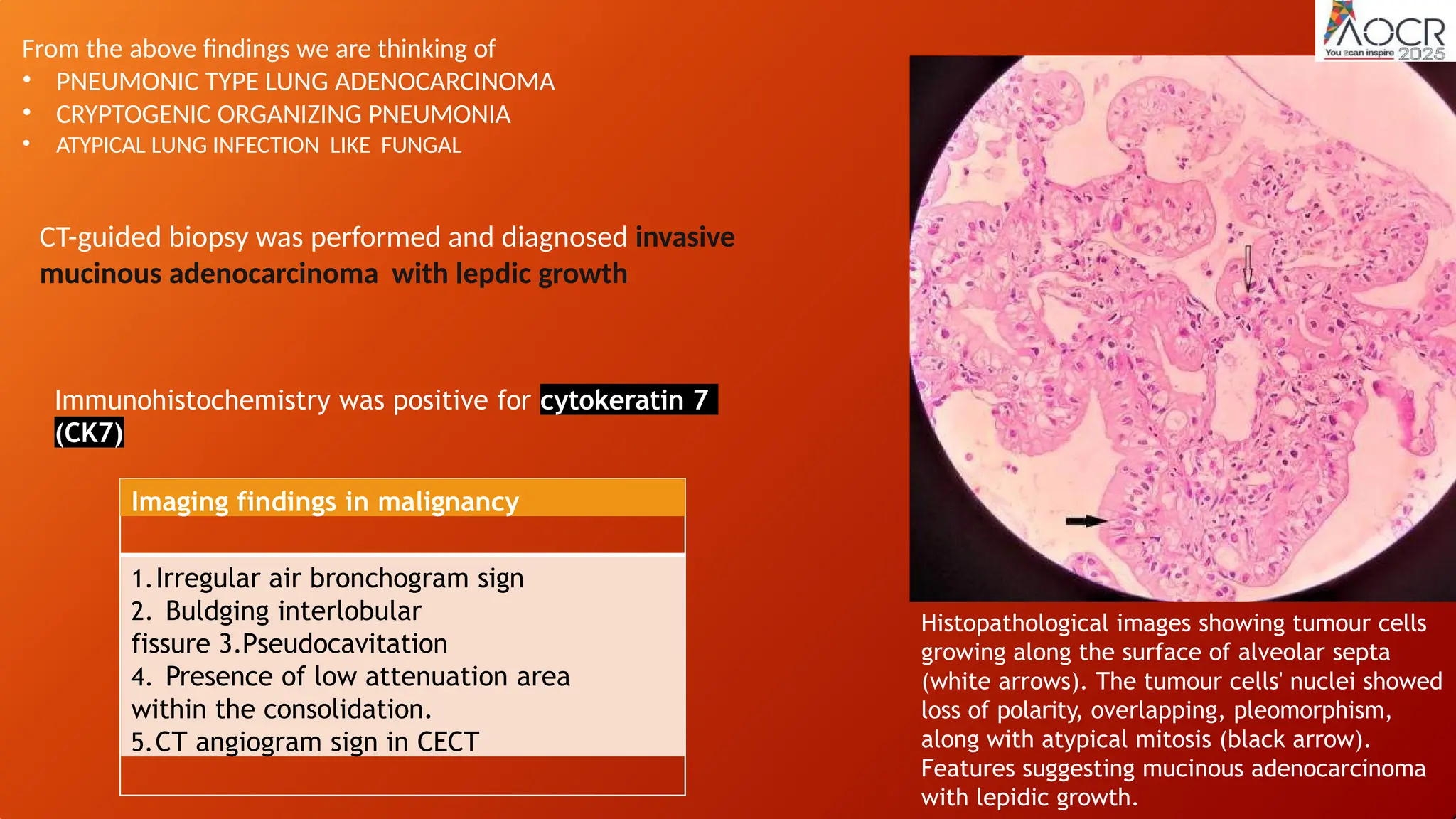 CONSOLIDATION POSTER DR ARYA-compressed.pptx
