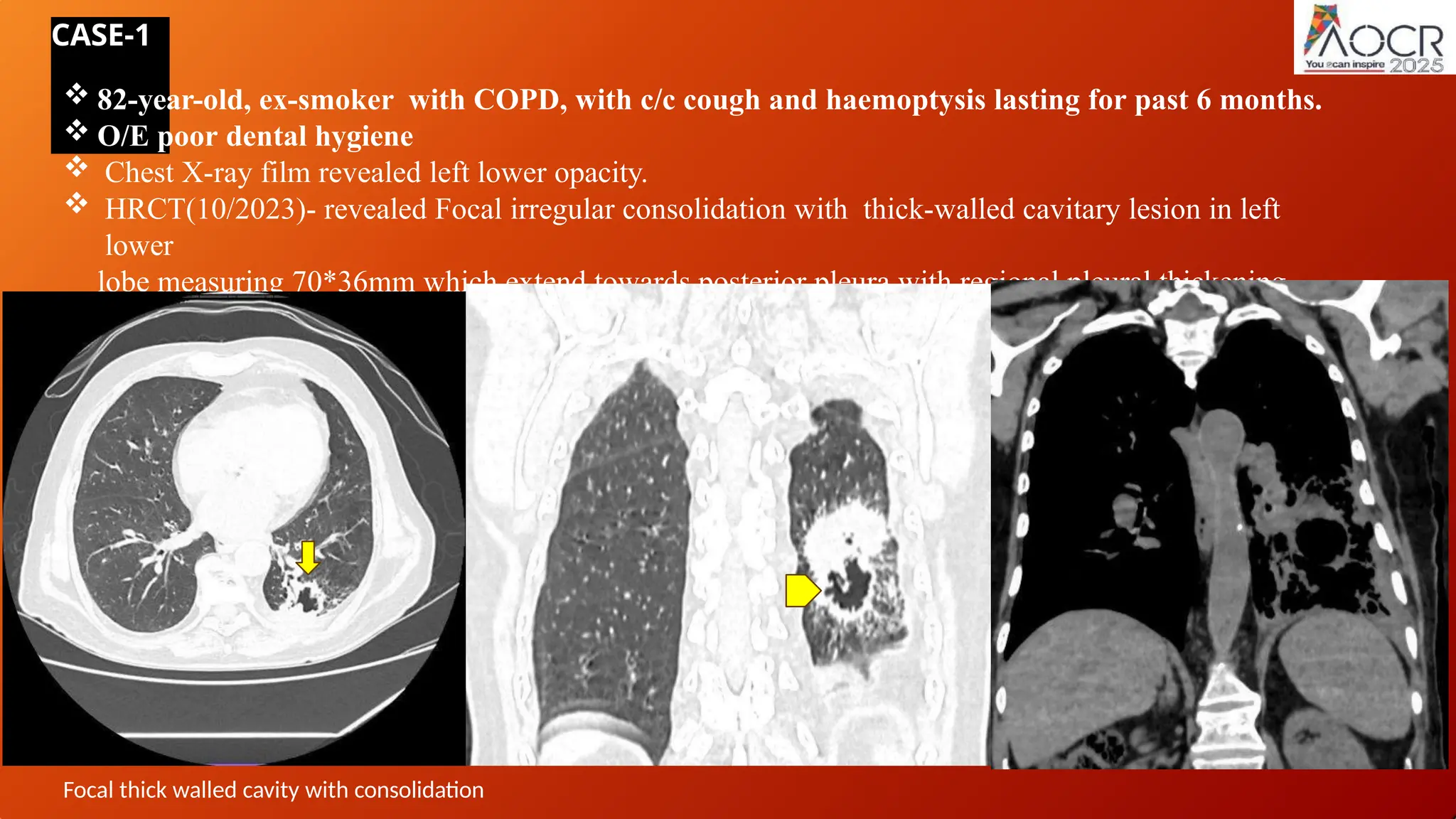 CONSOLIDATION POSTER DR ARYA-compressed.pptx