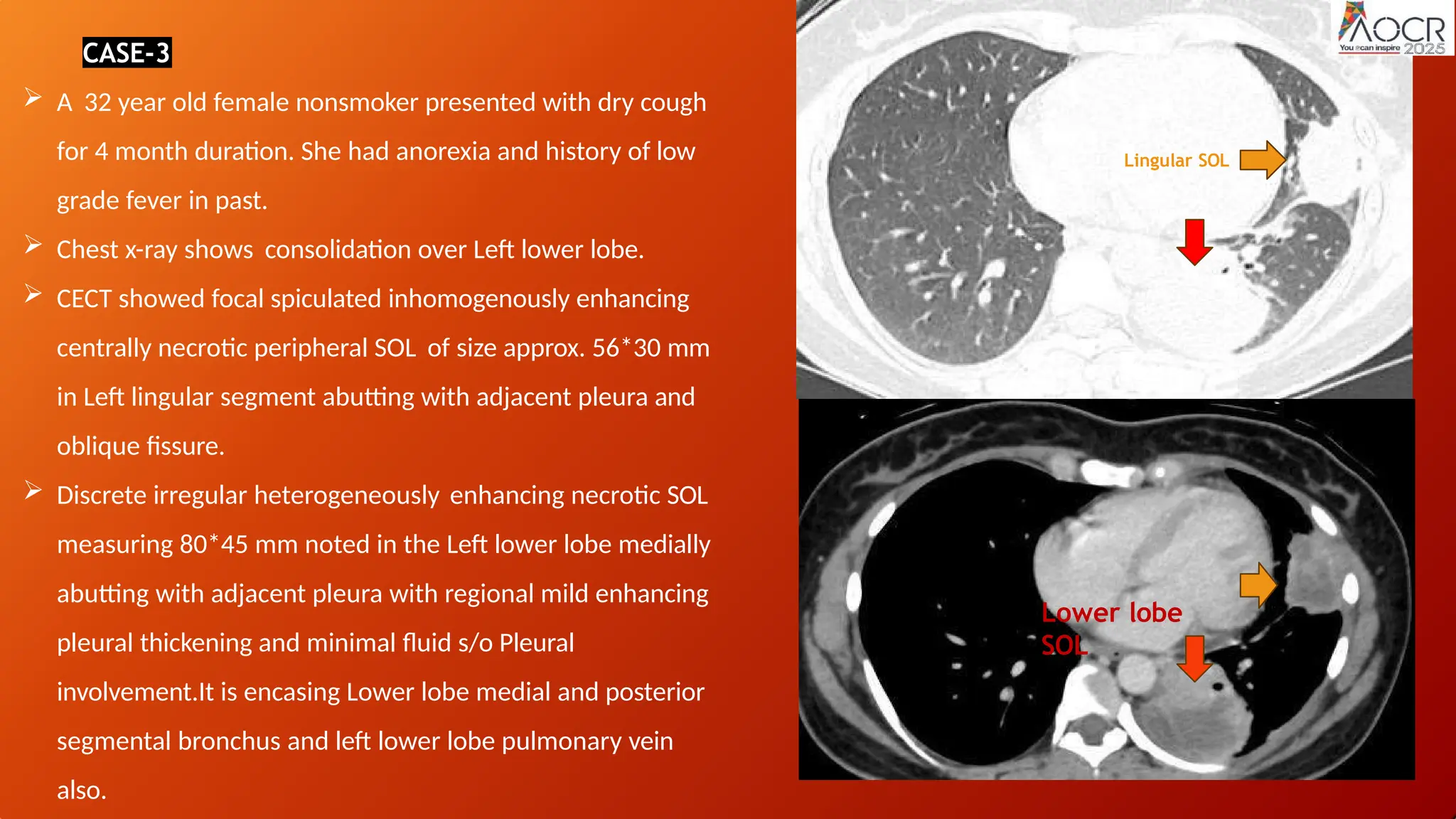 CONSOLIDATION POSTER DR ARYA-compressed.pptx
