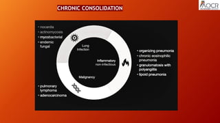 CONSOLIDATION POSTER DR ARYA-compressed.pptx