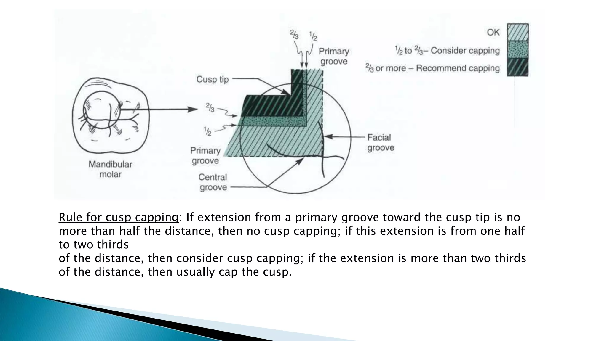 Fundamentals in tooth preparation (conservative dentistry) | PPTX