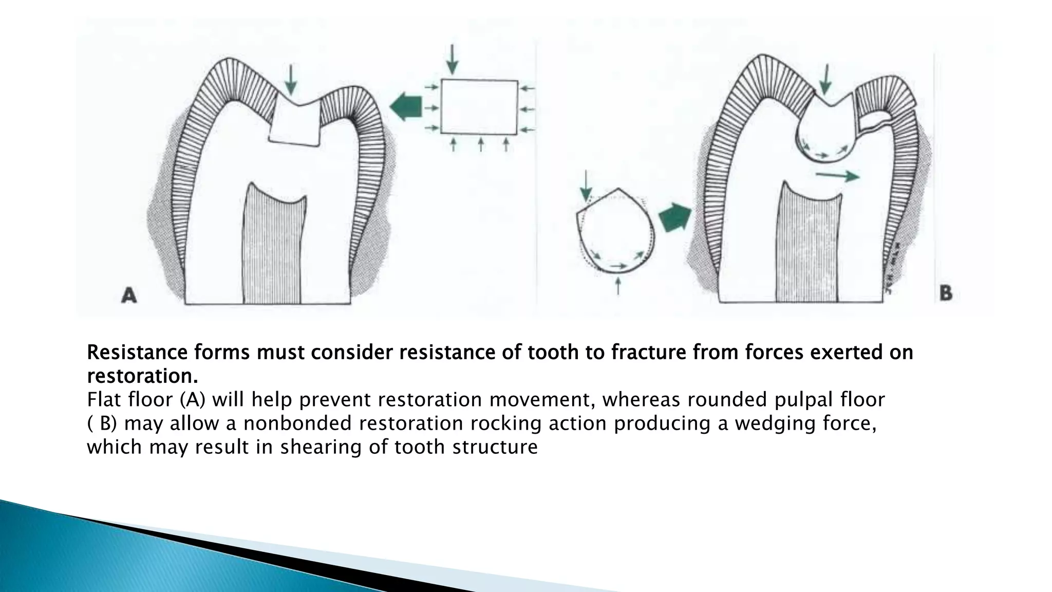 Fundamentals in tooth preparation (conservative dentistry) | PPTX