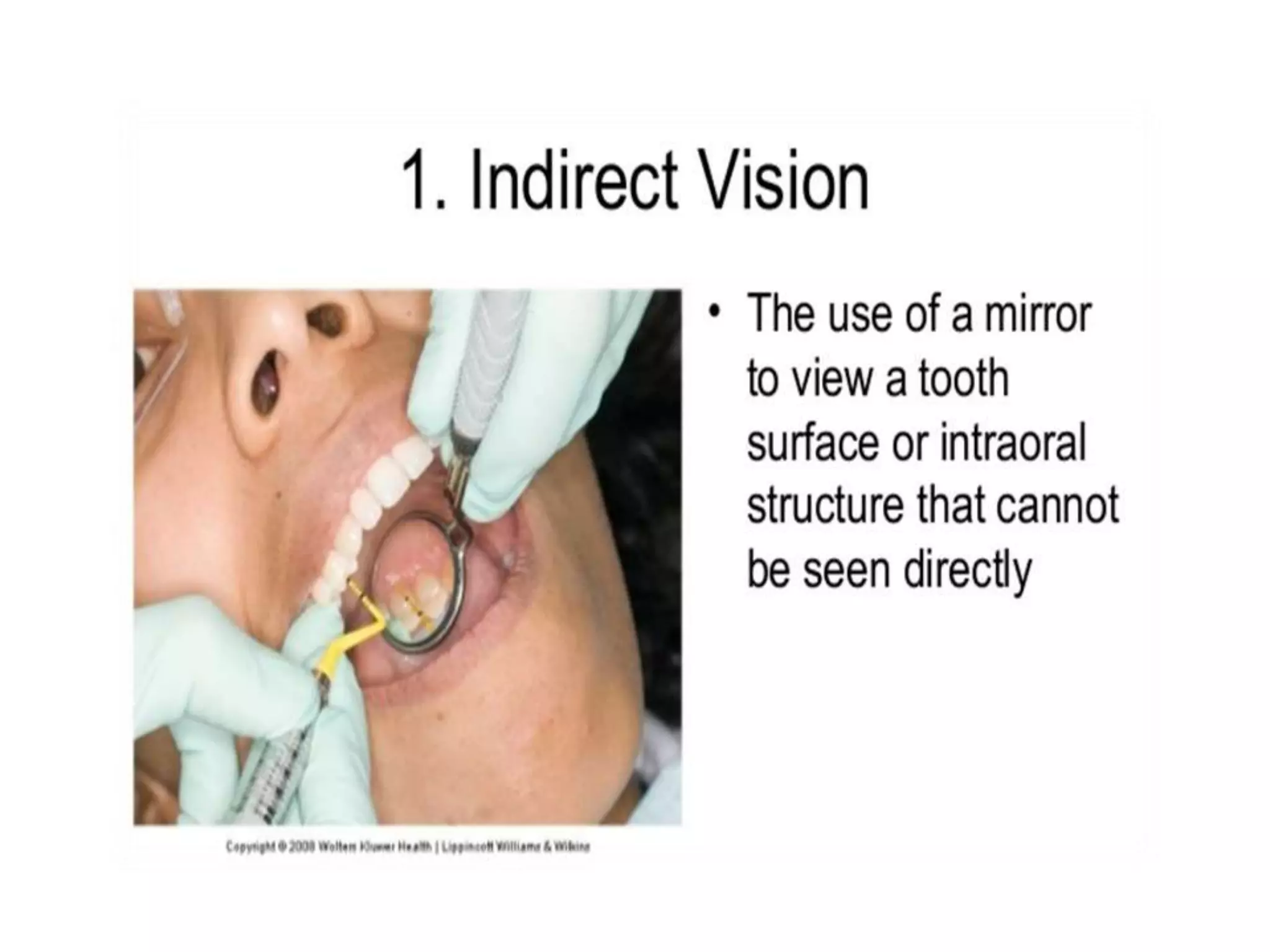 Instruments used in Conservative Dentistry | PPTX