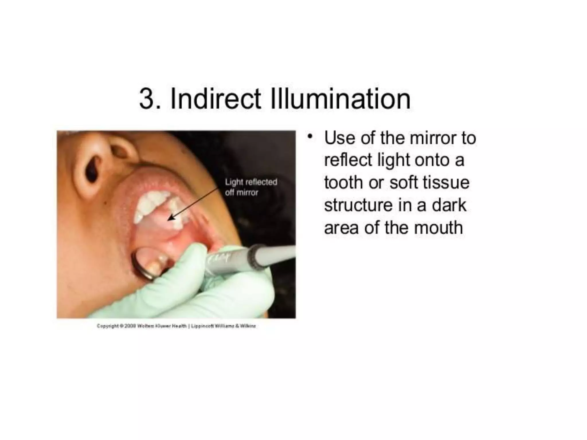 Instruments used in Conservative Dentistry | PPTX