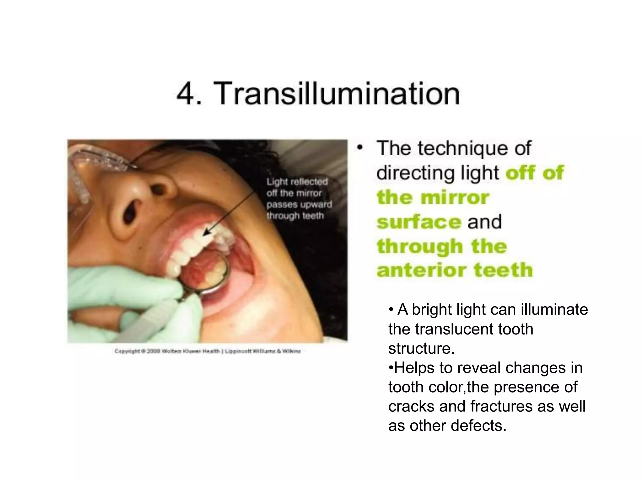 Instruments used in Conservative Dentistry | PPTX
