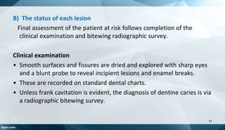 Caries Management System | PPTX