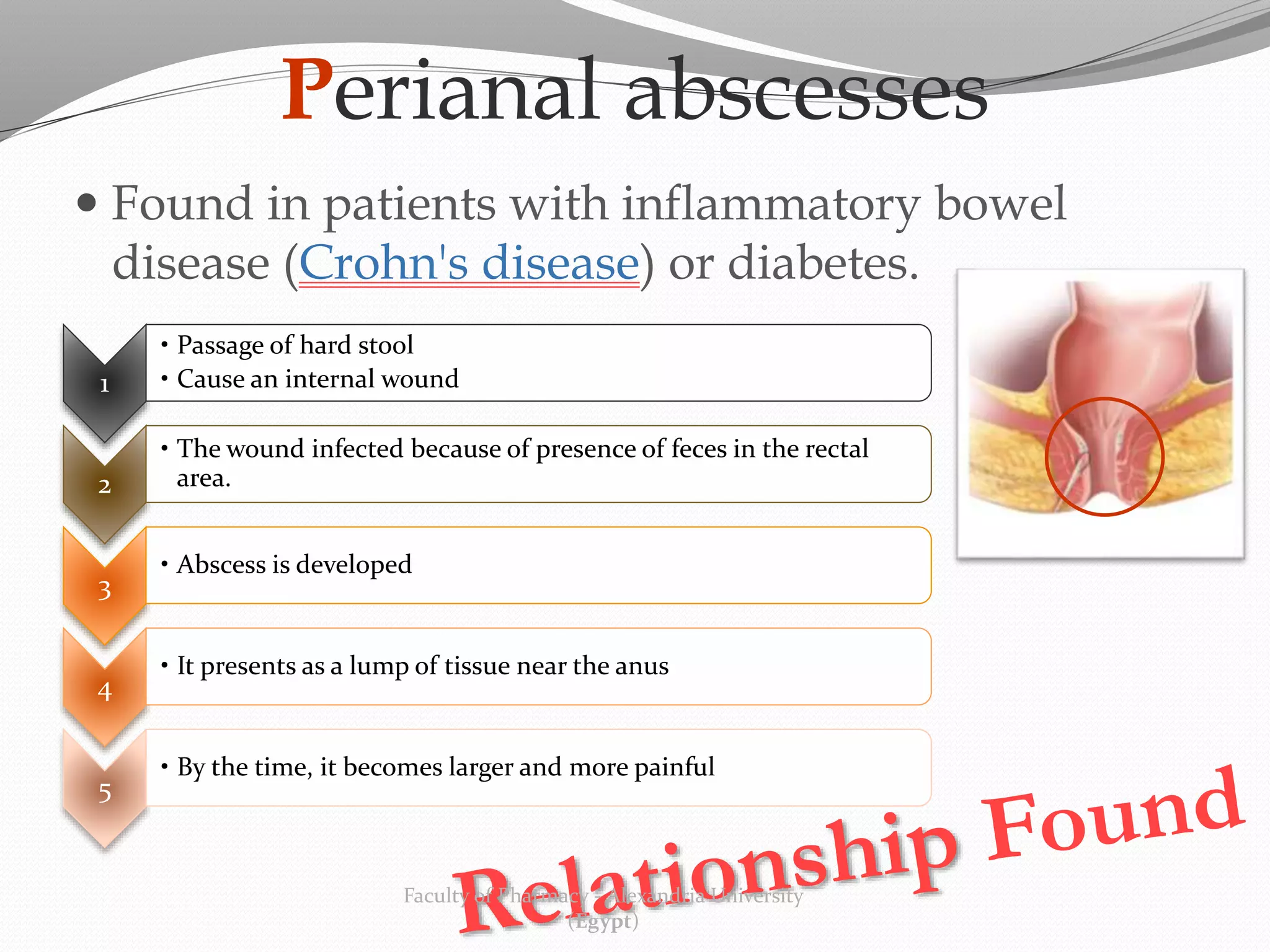 Constipation Definition and causes | PPTX