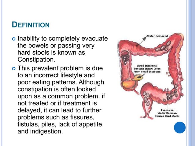 Constipation | PPTX